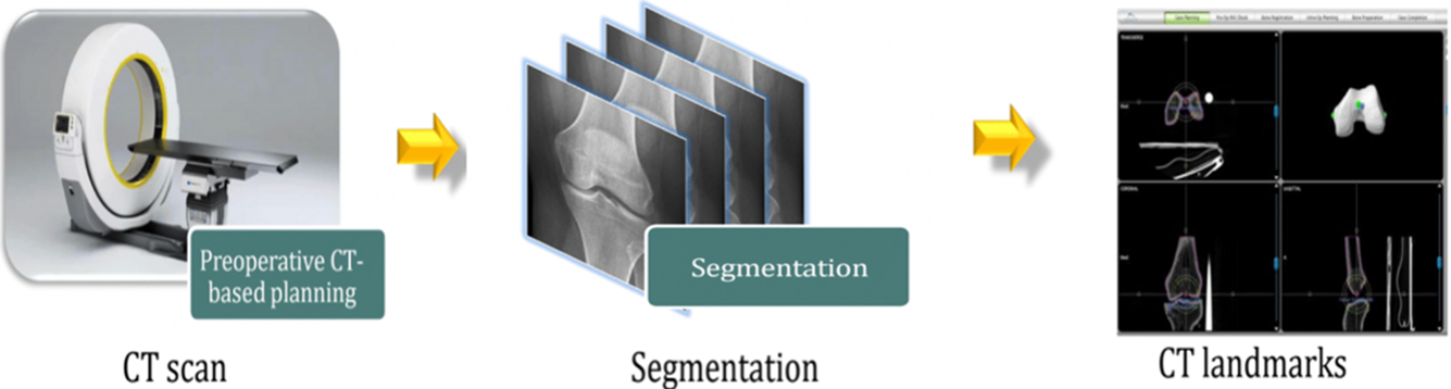 Acquisition du robot Mako® | Hôpitaux Robert Schuman